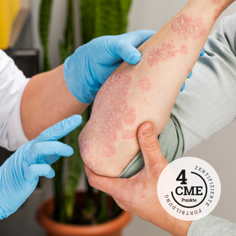 CME-Punkte kostenlos | Zertifizierte Fortbildungen für Ärzte